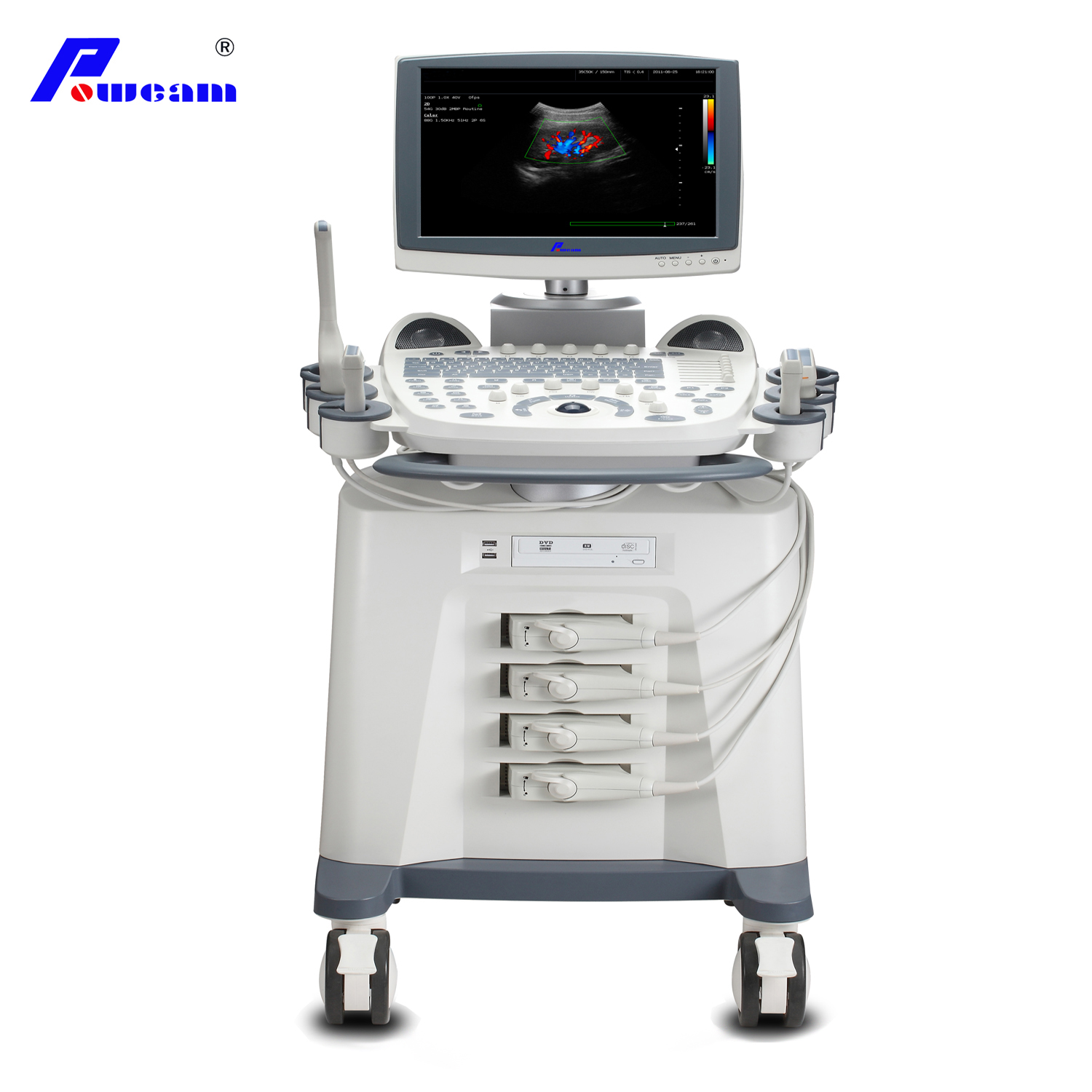 Ce, FDA Approved 4D Color Doppler Ultrasound Scanner (D70) from China ...