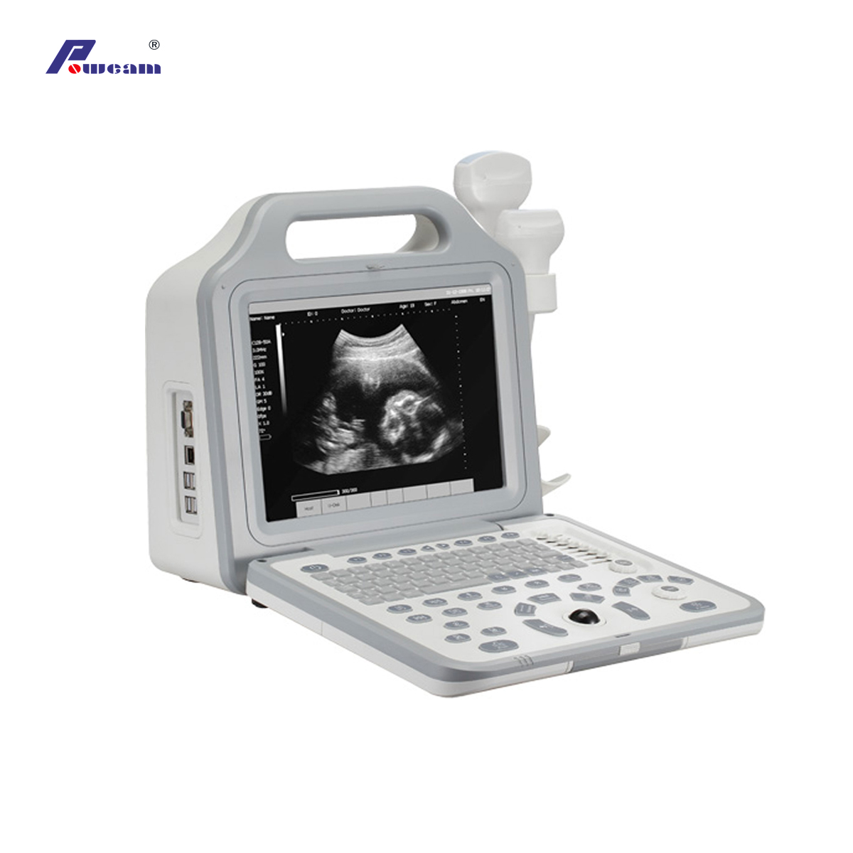 Digital Laptop Portable Ultrasound Scanner with LCD Display from China ...